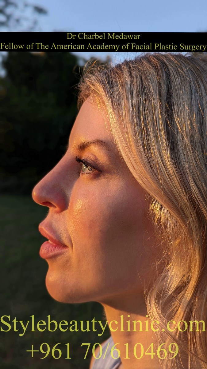 Understanding Liquid Facelift Costs Near You – Dr Charbel Medawar ...